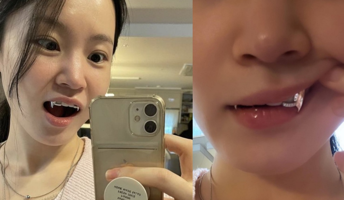 Lee Hi Asks Fans To Help Her Decide Which Grillz Design She Wants Next Allkpop