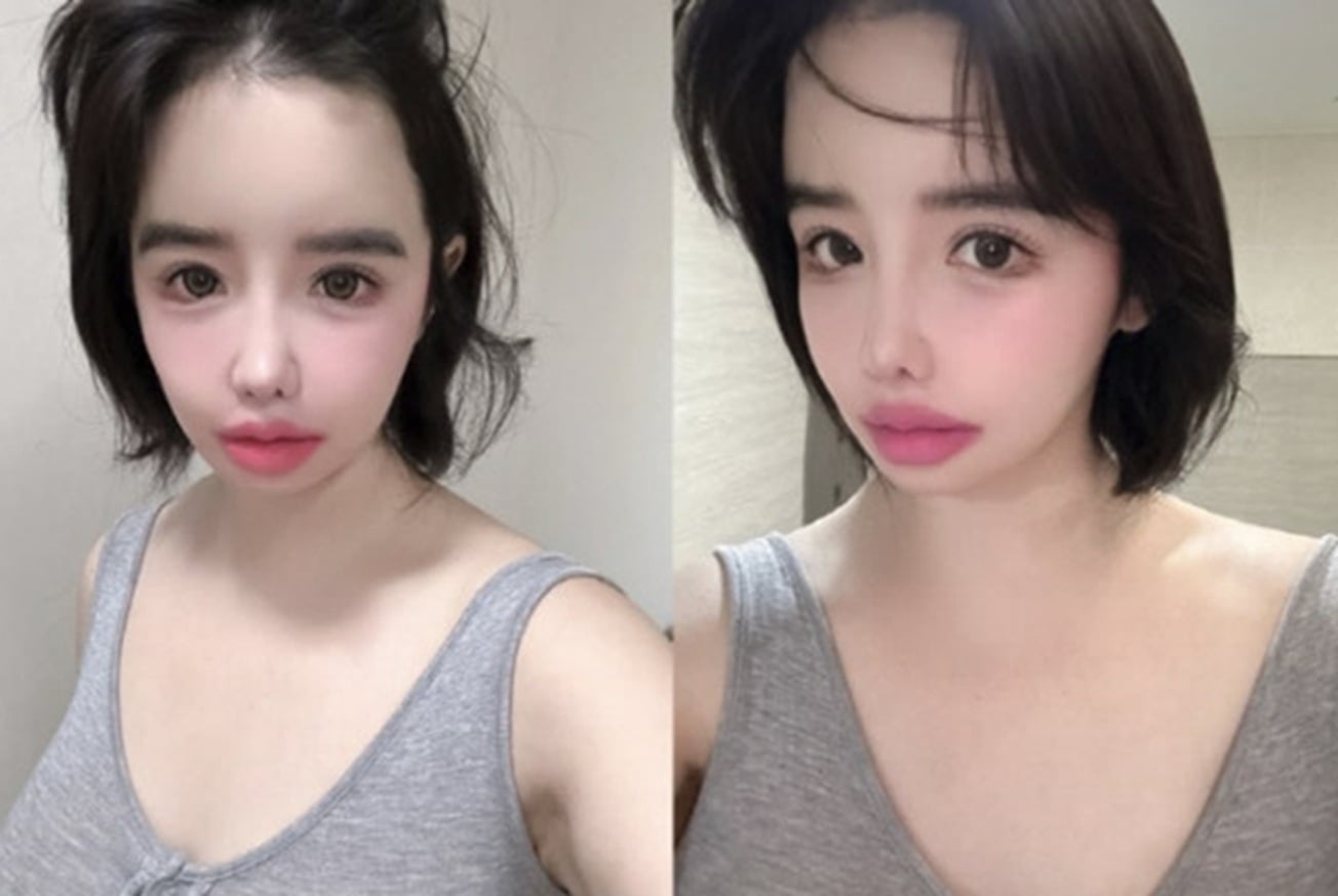 2NE1's Park Bom shows bold pink overlined lips | allkpop