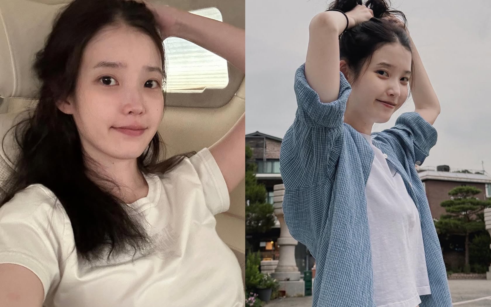 Iu Plastic Surgery Before And After